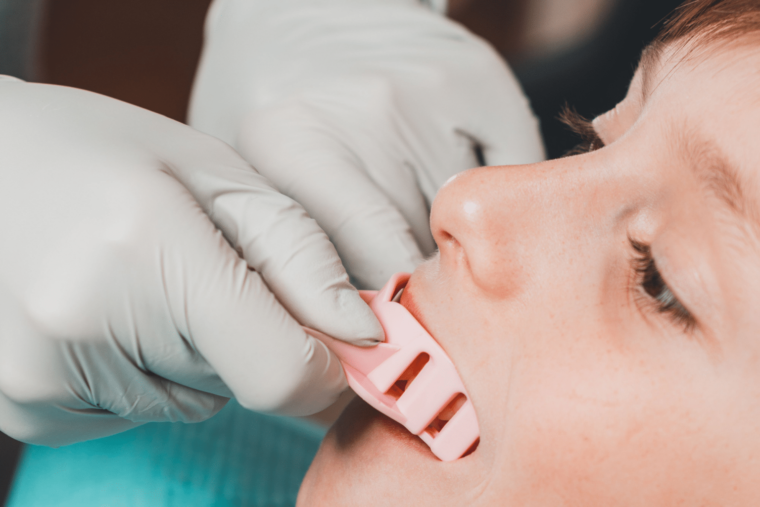 Myobrace | Dr. Scott Chandler, DMD | Dentist in Park City, UT