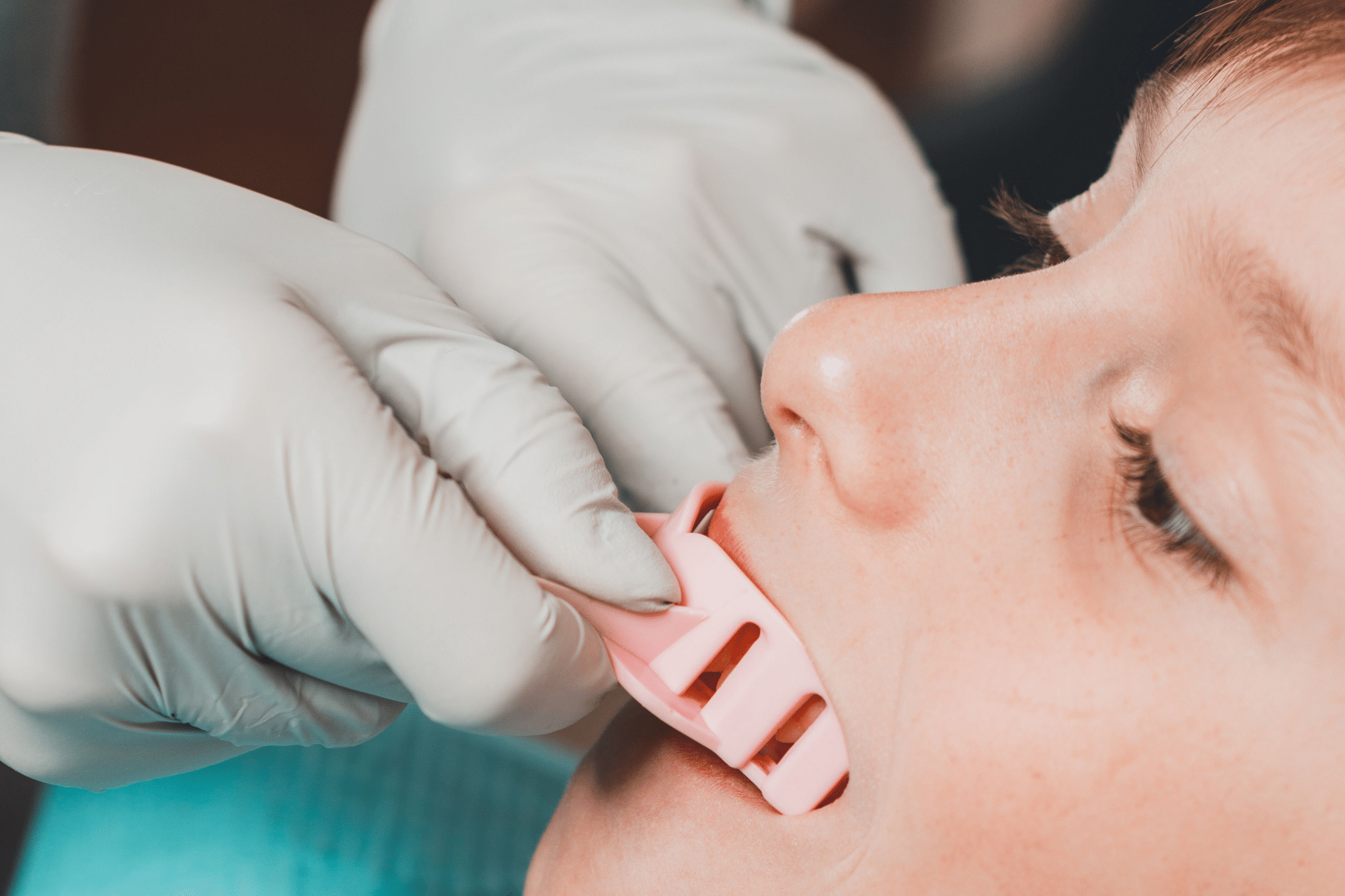 Myobrace | Dr. Scott Chandler, DMD | Dentist in Park City, UT